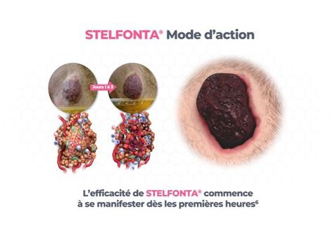 Découvrir l'innovation Stelfonta® [Vidéo]